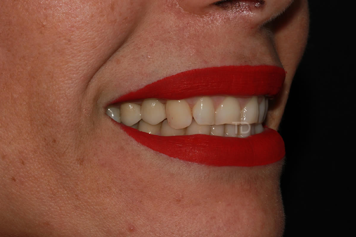 Our Patients - Dental Implants Abroad